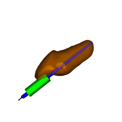 Endoguide (Guia para Endodontia) - Odontoimagem Lab