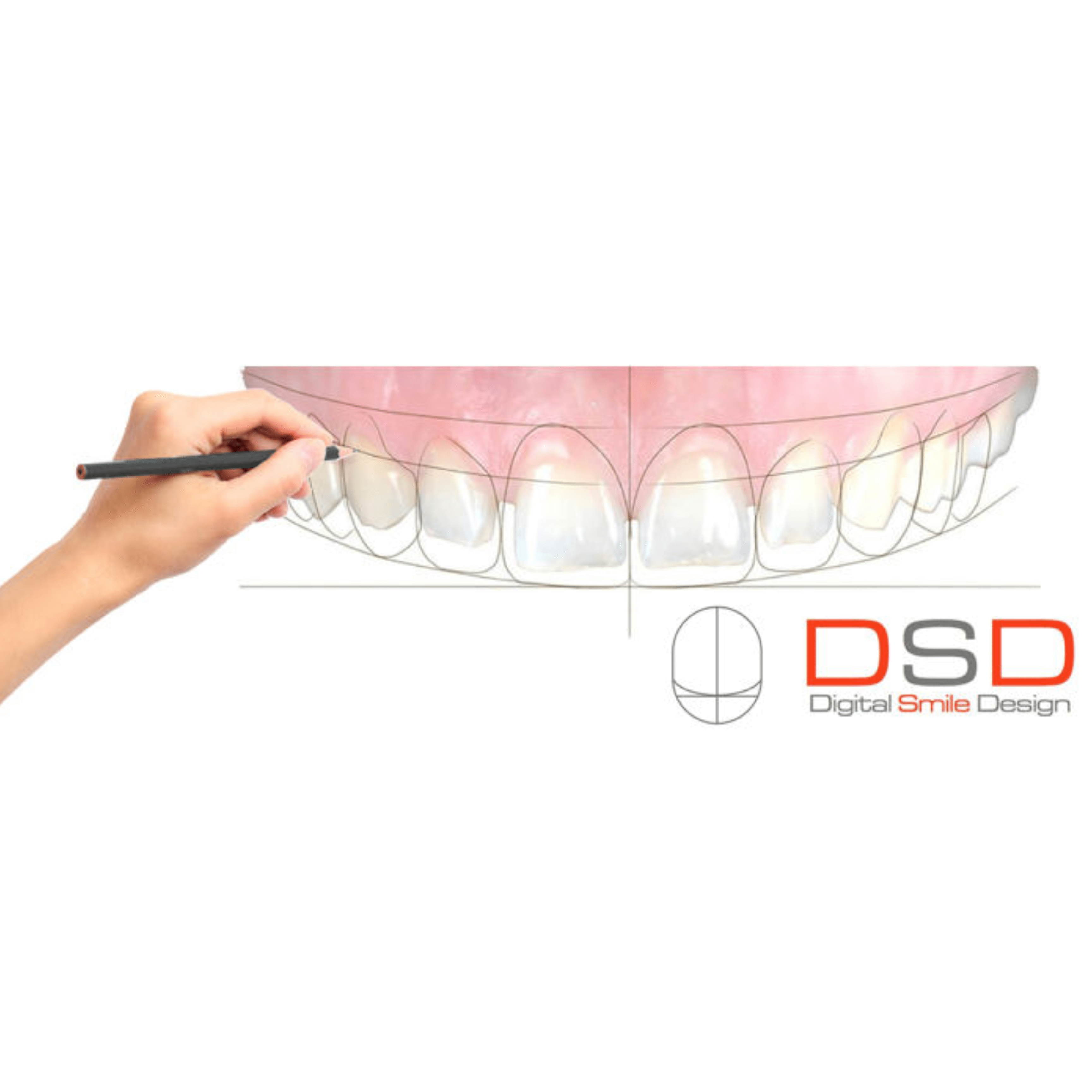 DSD 2D - Odontoimagem Lab